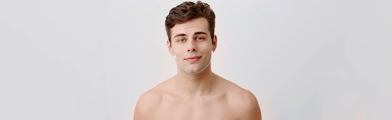 Facial masculinization Surgery - FMS Surgery - Masculinization Surgery ...